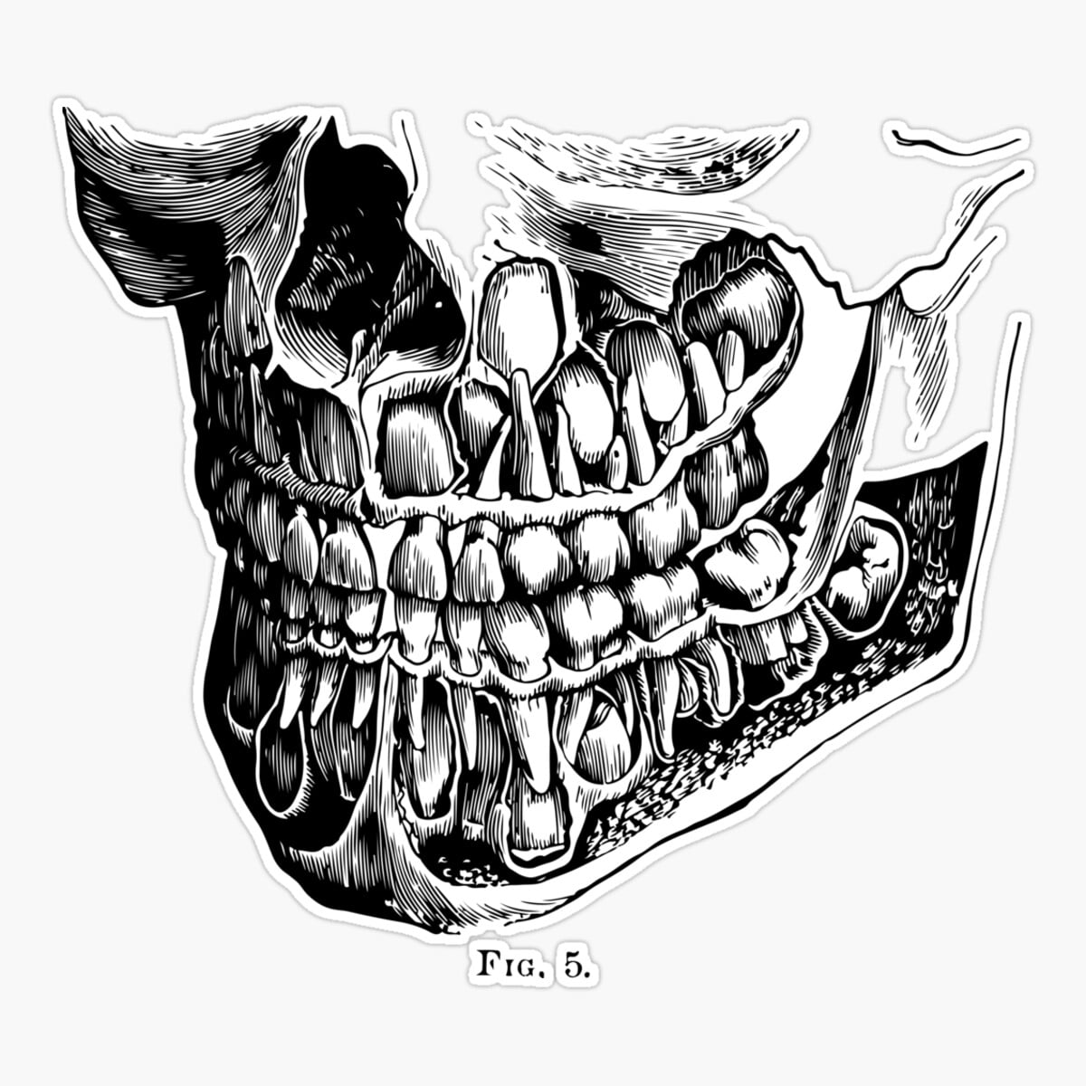 Maneki Medieval Anatomy Engraving Jaw Skull Er, Phone Decal Water ...