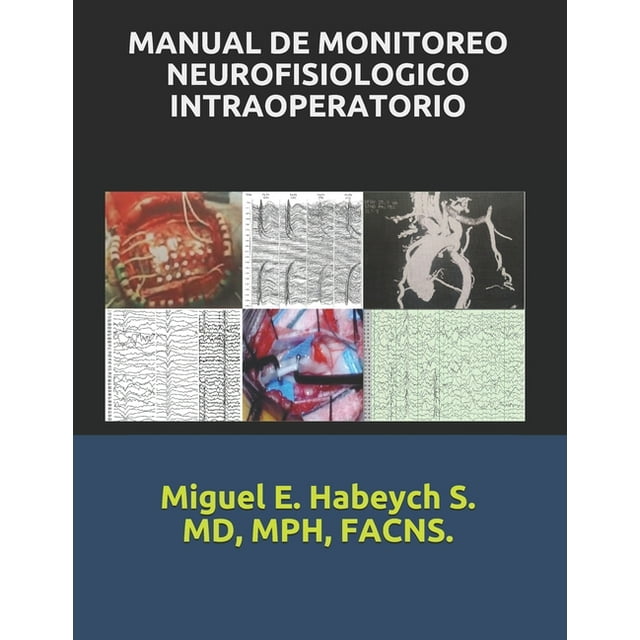 Manual de Monitoreo Neurofisiológico Intraoperatorio. (Paperback ...