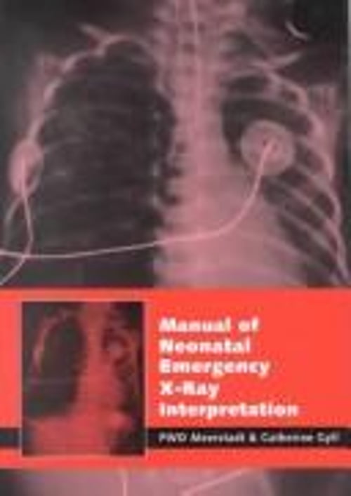 Pre-Owned Manual of Neonatal Emergency X-Ray Interpretation (Paperback ...