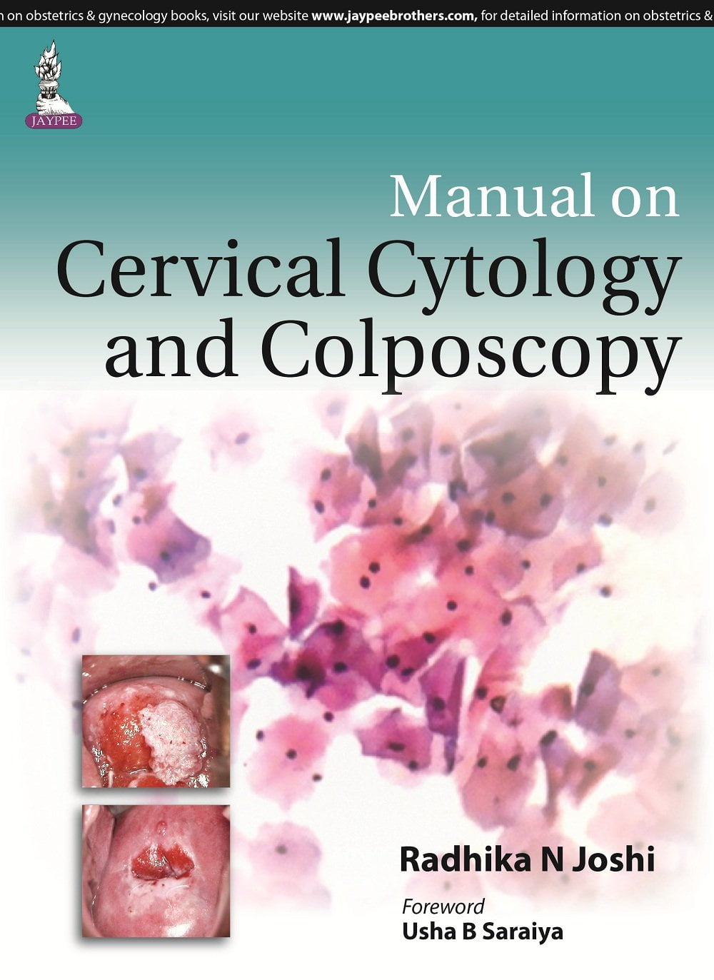 Manual on Cervical Cytology and Colposcopy - Joshi, Radhika N ...