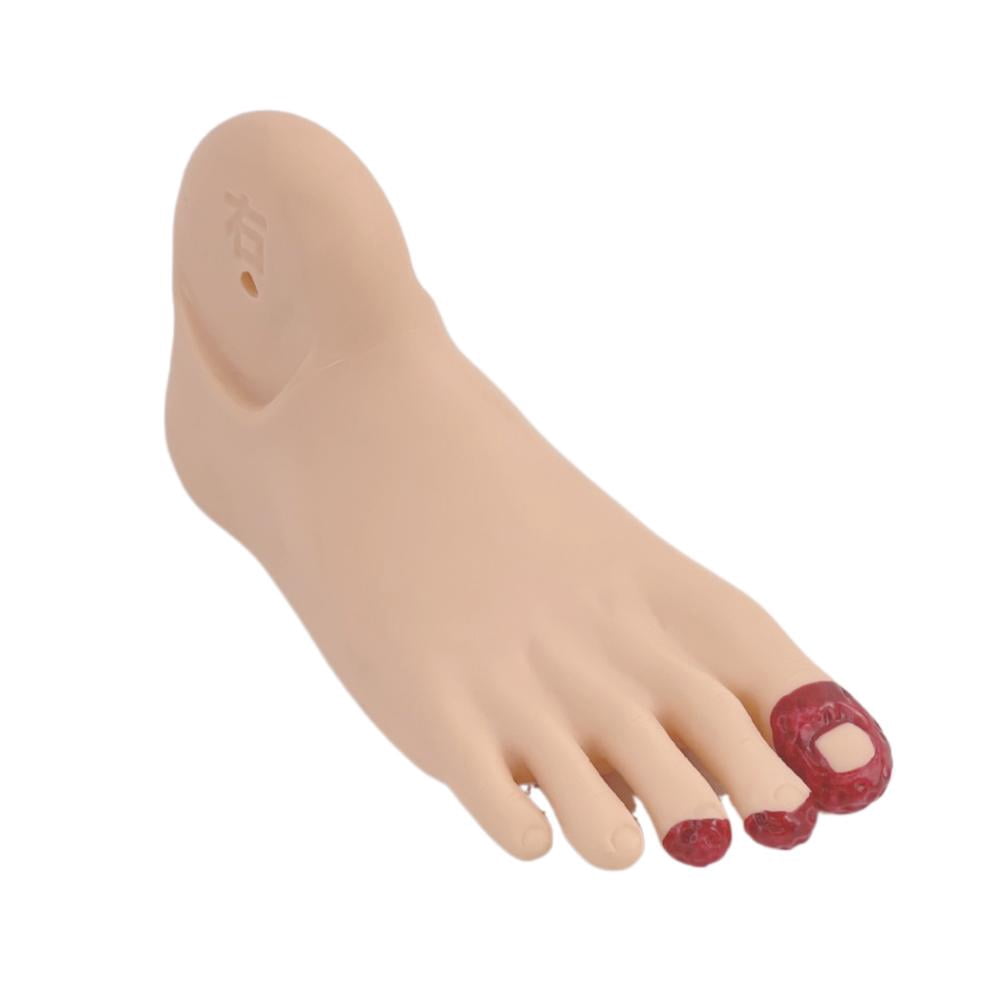 MapleMart Deformed Foot Model For Elderly People'S Foot Lesions Care ...