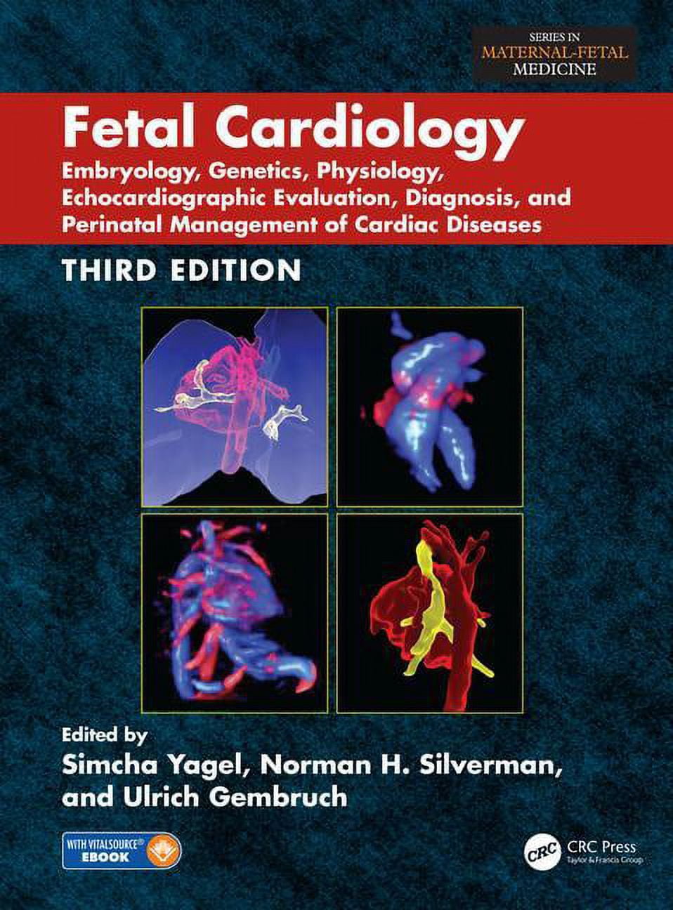 Maternal-Fetal Medicine: Fetal Cardiology: Embryology, Genetics ...