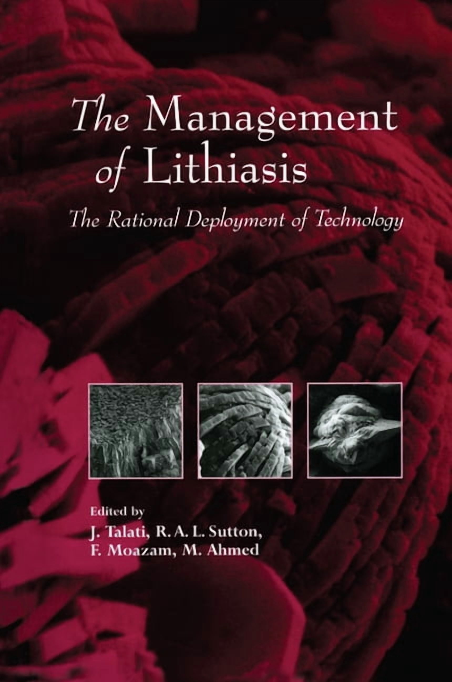 Mathematics and Its Applications The Management of Lithiasis: The ...