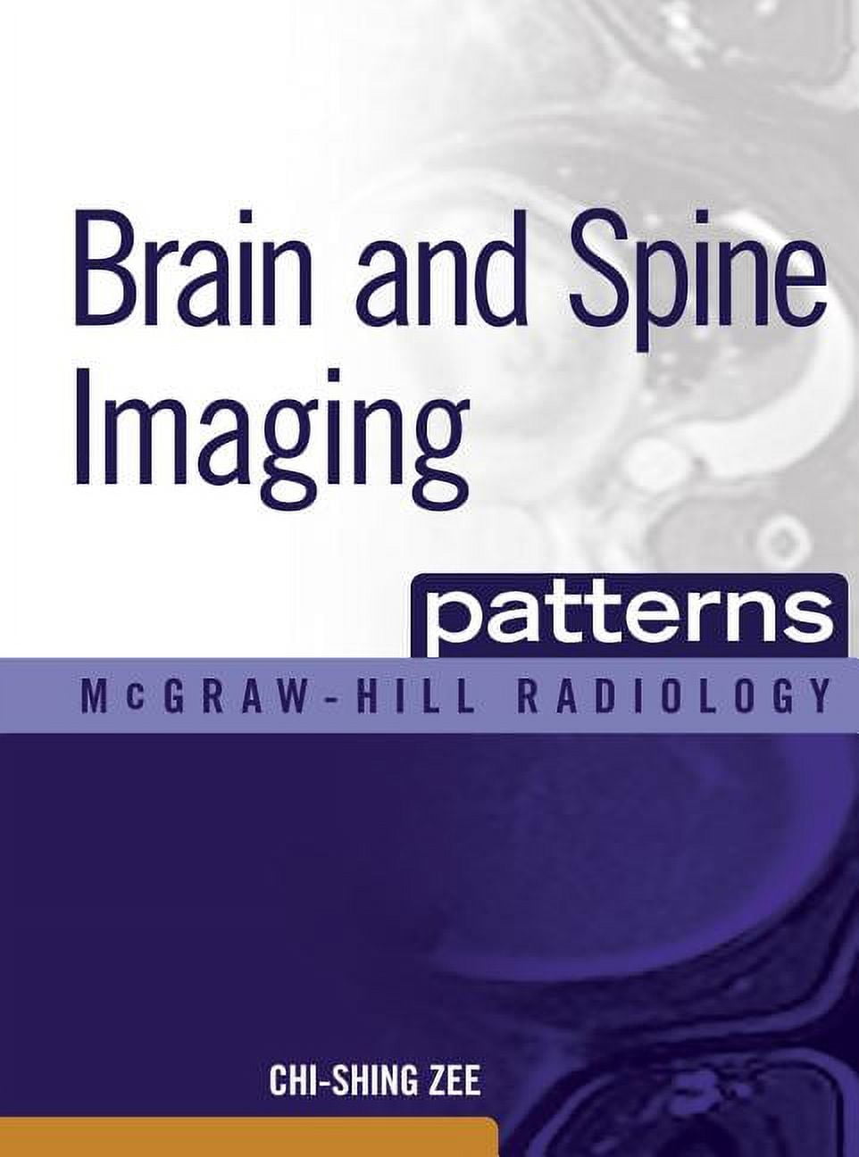 McGraw-Hill Radiology Brain and Spine Imaging Patterns: Brain & Spine ...