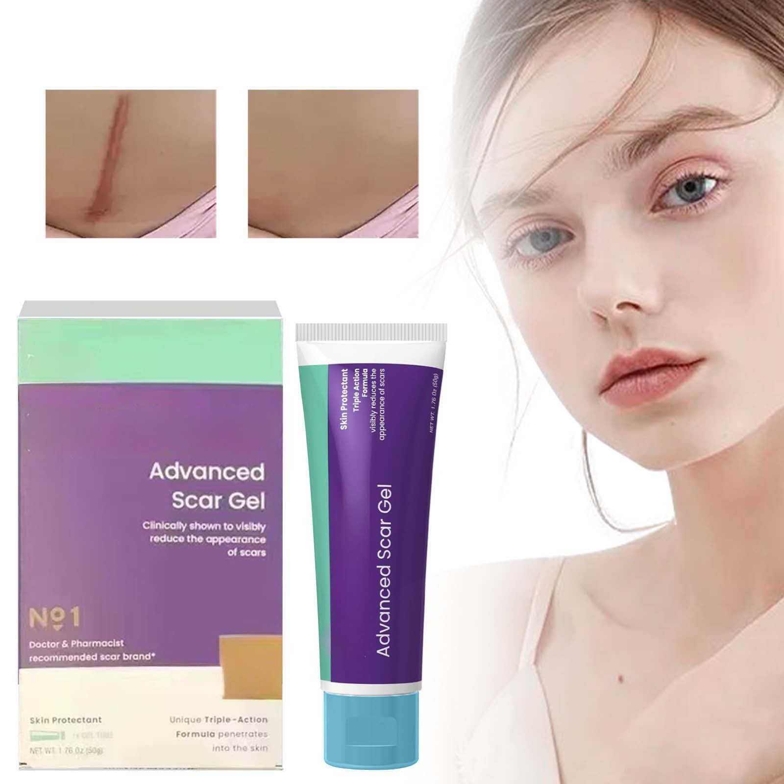 Mederma Advanced Scar Gel, Treats Old and New Scars, Silicone Scar Gel,Scar Removal Cream,Scar ...