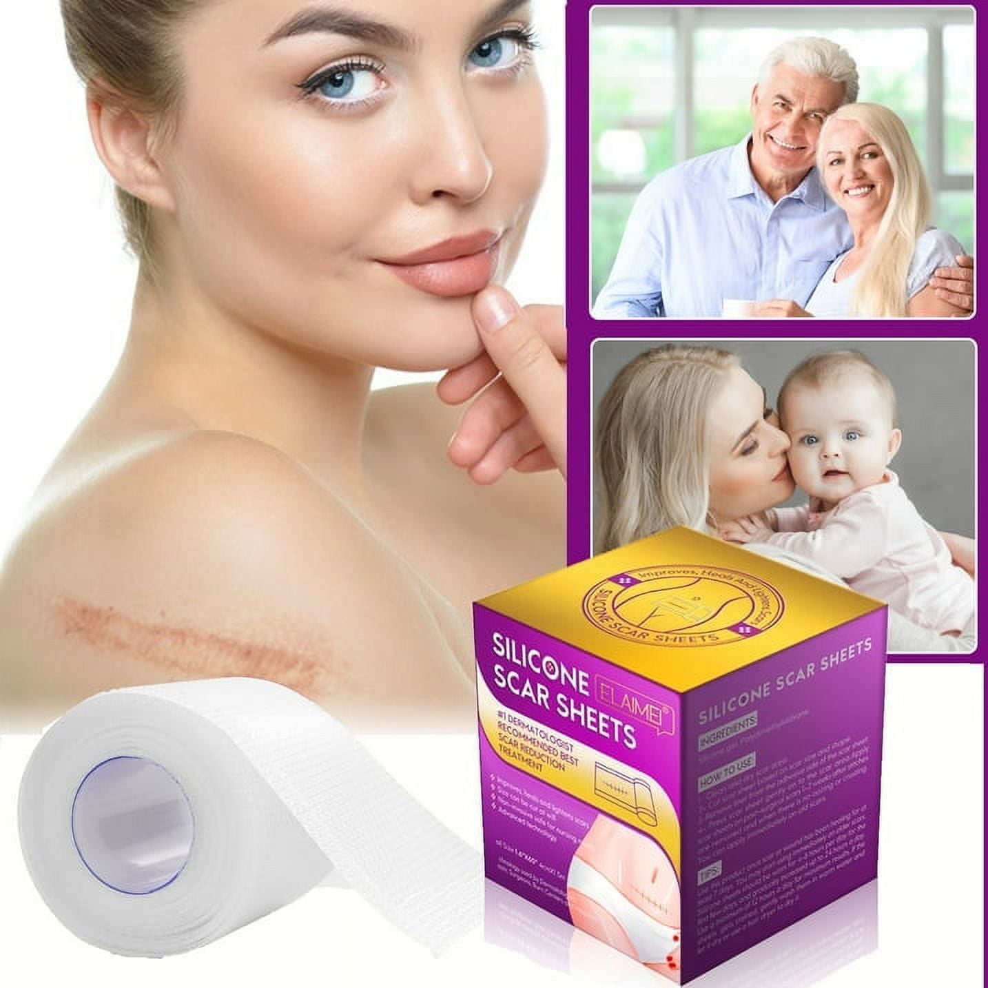 Medical Grade Silicone Scar Sheets,Painless Scar Reducing Treatments, 1 ...