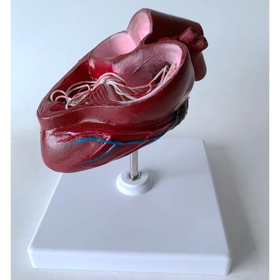 Medical Science Dog Heart Pathology Model Canine Heart Dog Heartworm ...