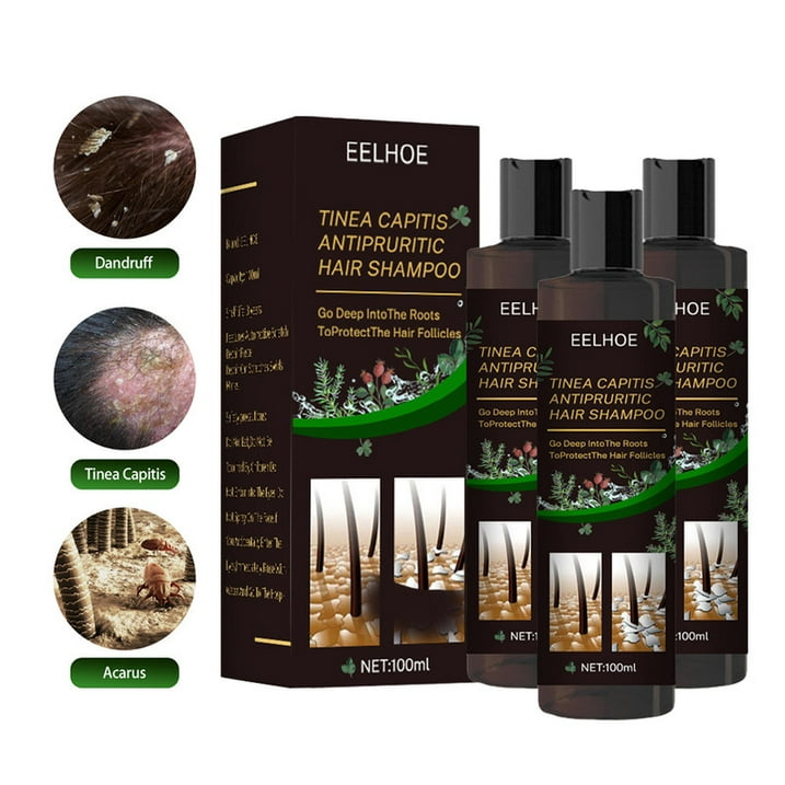 Medicated Psoriasis Shampoo,Hair Oil Control Shampoo Anti-itching ...