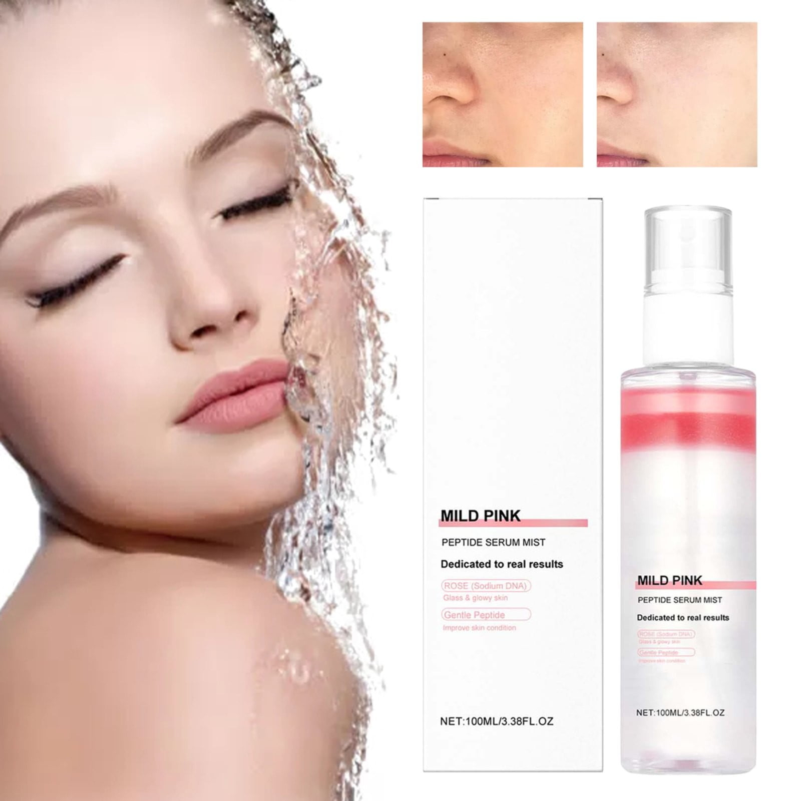 Medicube Niacinamide Rose Moisturizing Mist (hoygi) Peptide Spray I ...