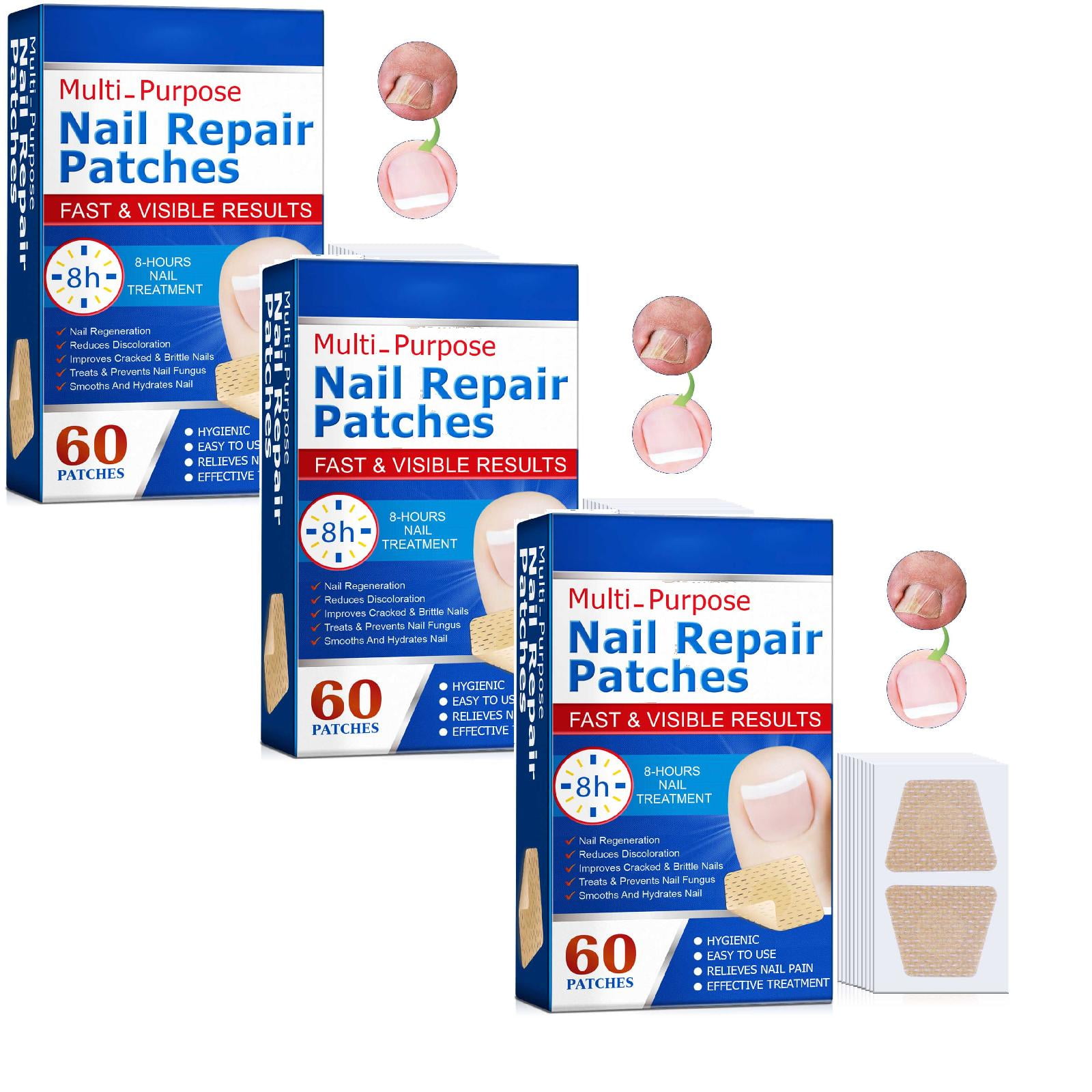 Men Women Toenail Fungus Treatment Extra Strength Fungal Nail Patches ...