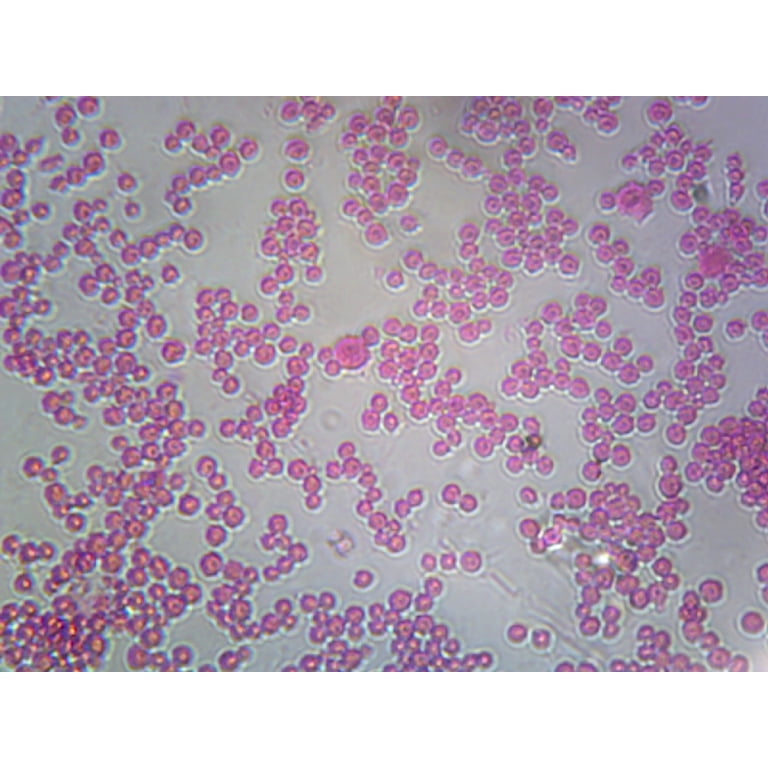 Neisseria Meningitidis Gram Stain Meningitis Lab Manual: Primary