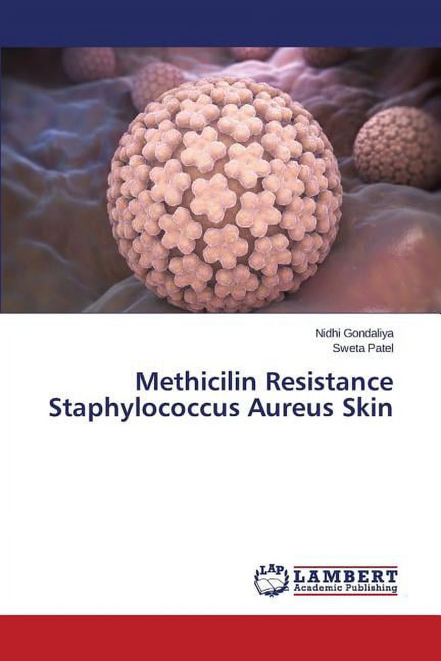 Methicilin Resistance Staphylococcus Aureus Skin (Paperback) - Walmart.com