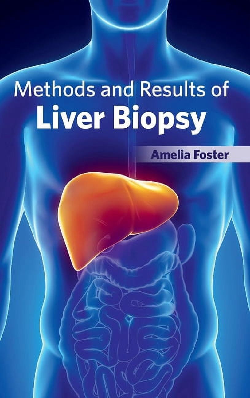 Methods and Results of Liver Biopsy, (Hardcover) - Walmart.com