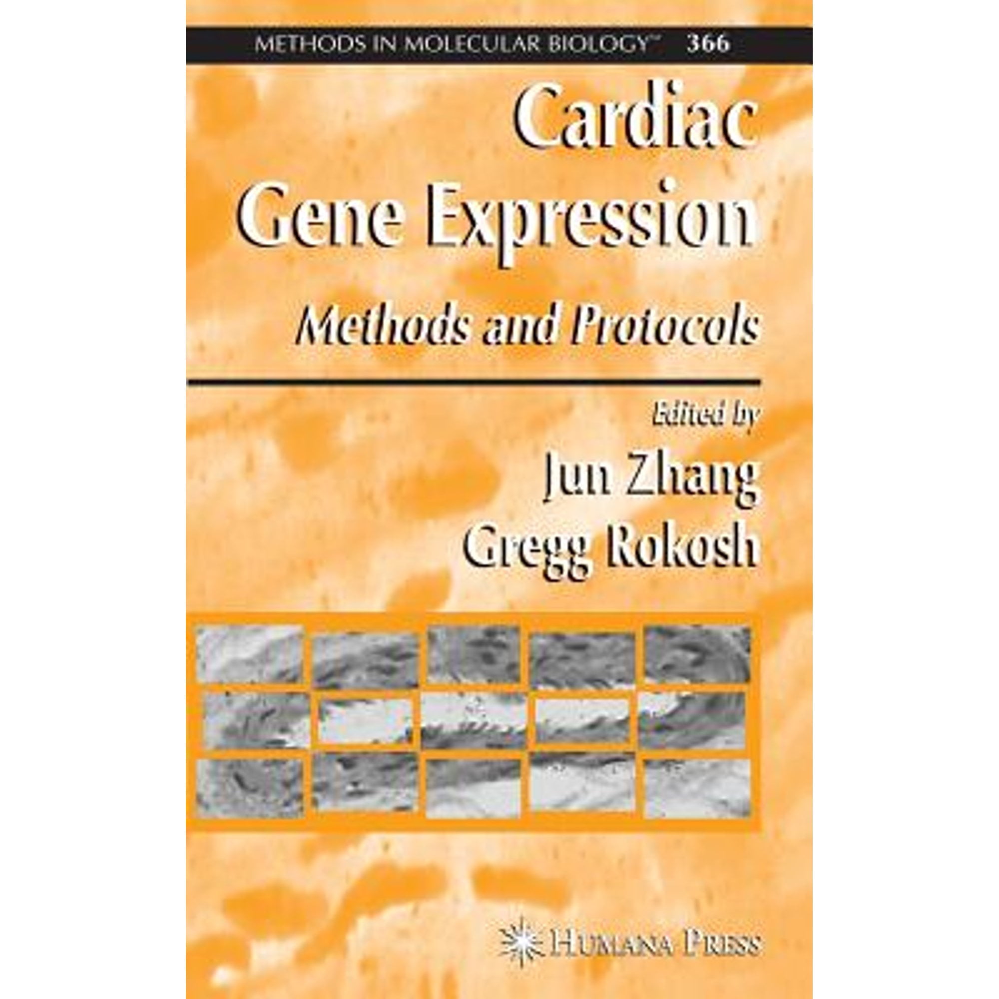 Pre-Owned Cardiac Gene Expression: Methods and Protocols (Hardcover) by ...