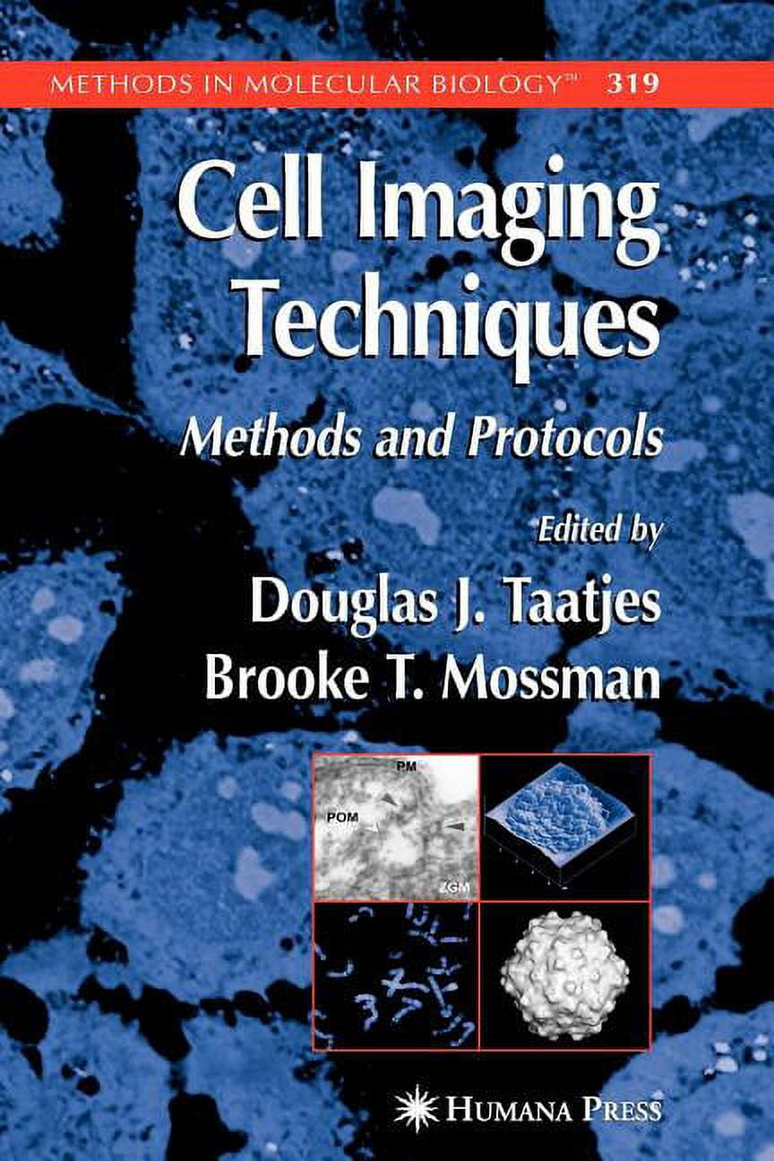 Methods in Molecular Biology: Cell Imaging Techniques (Paperback) - Walmart.com