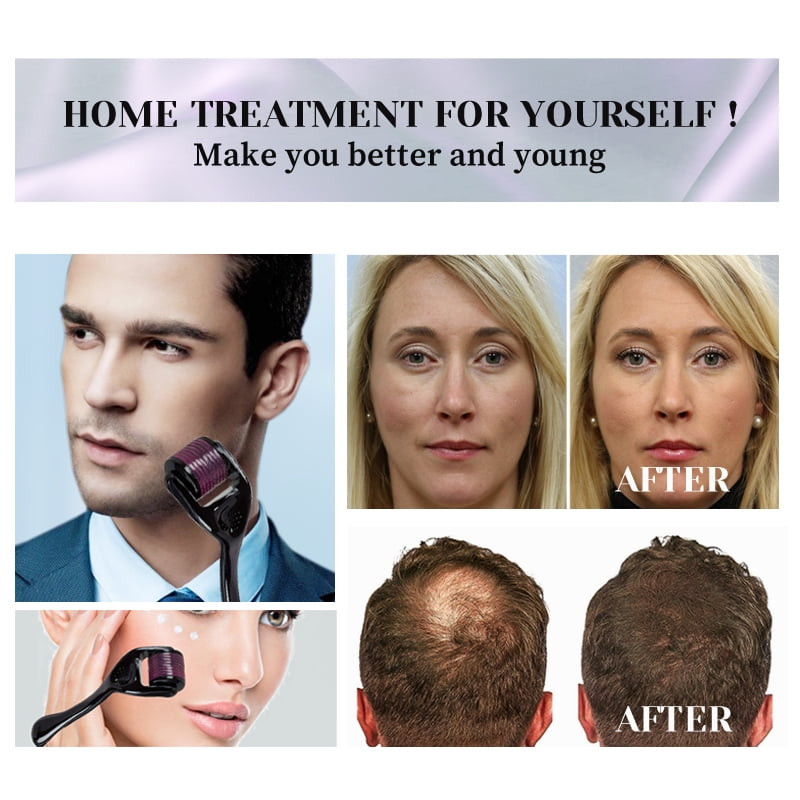 Micro Needle Roller Pen Derma Roller 540 Micro Needles Mezoroller ...