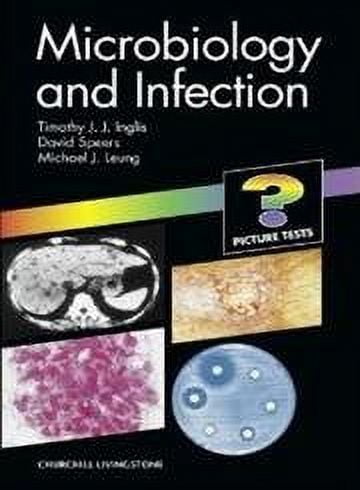 Microbiology and Infection: A Colour Guides Title (Paperback) by ...