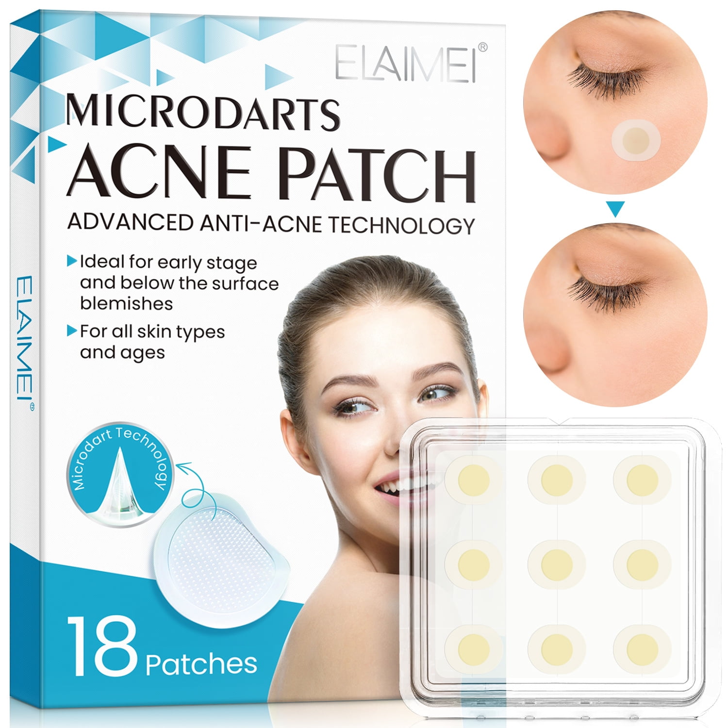 Microneedle Hydrocolloid Acne Patch – Fast Healing & Blemish Care ...