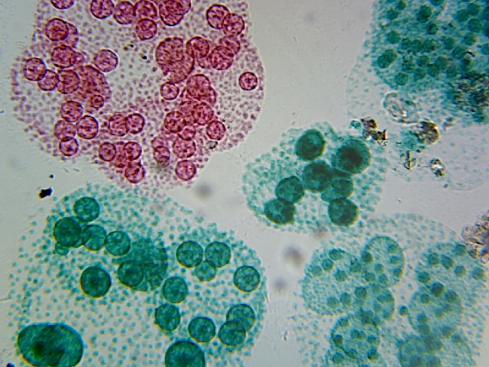 Microscope Slide, Volvox, Asexual, Reproduction W.M. Colonial Algae ...