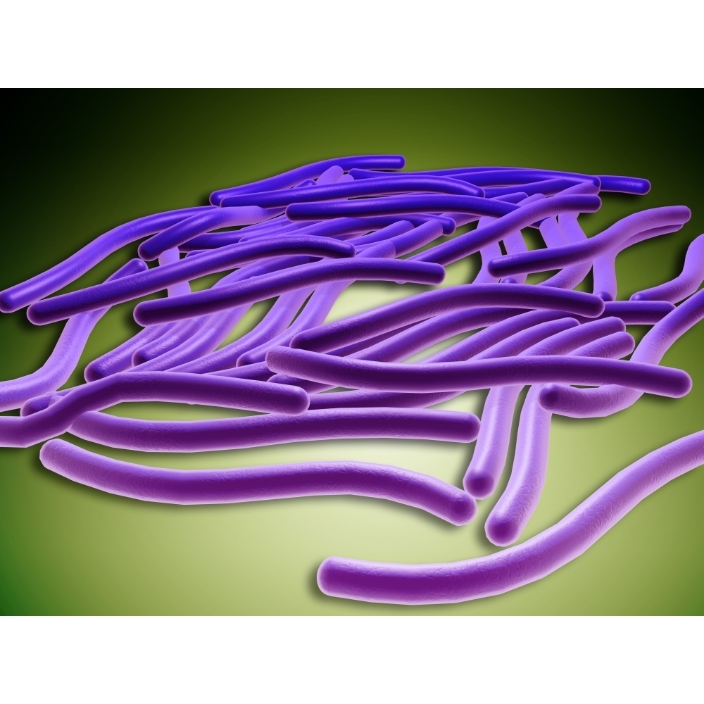 Microscopic view of Legionella pneumophila Poster Print - Walmart.com