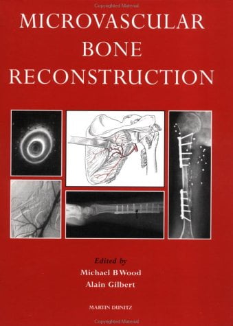 Microvascular Bone Reconstruction - Wood, Michael B - Walmart.com