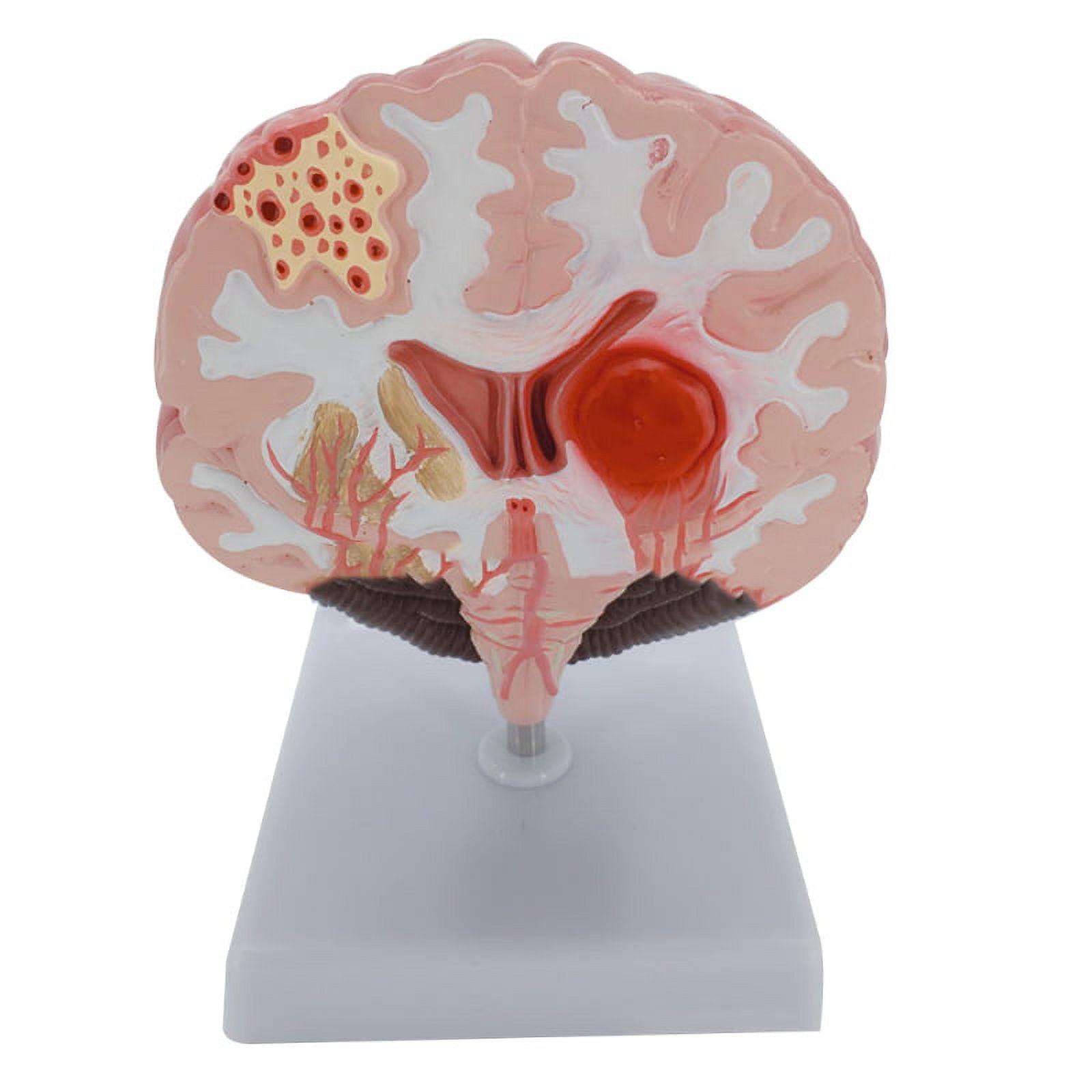 Milue Human Brain Model with Cerebral Cortex Brain Stem Arteries Etc ...