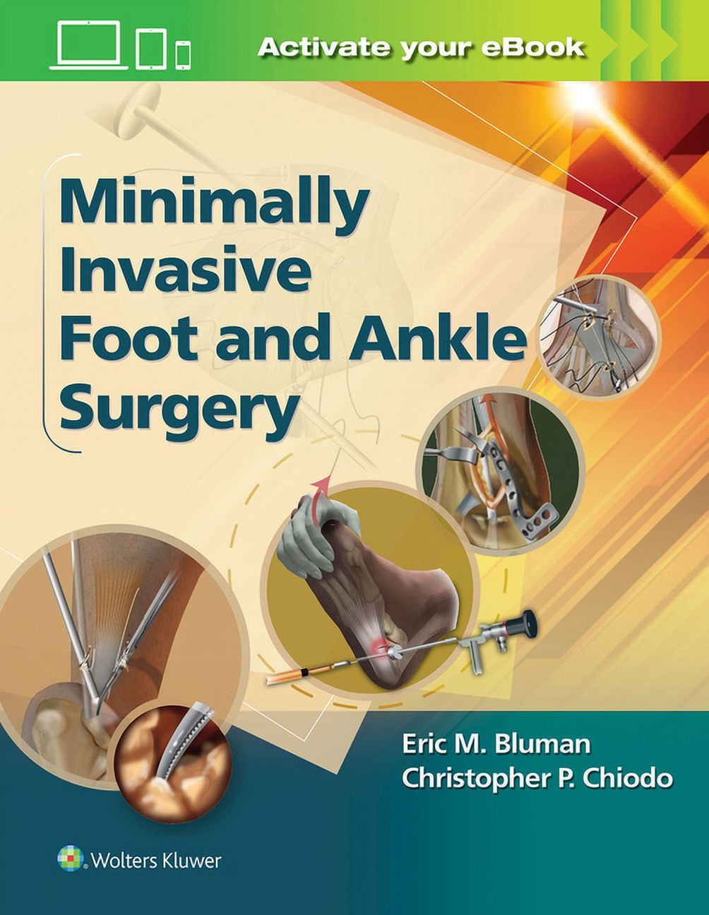 Minimally Invasive Foot & Ankle Surgery - Walmart.com