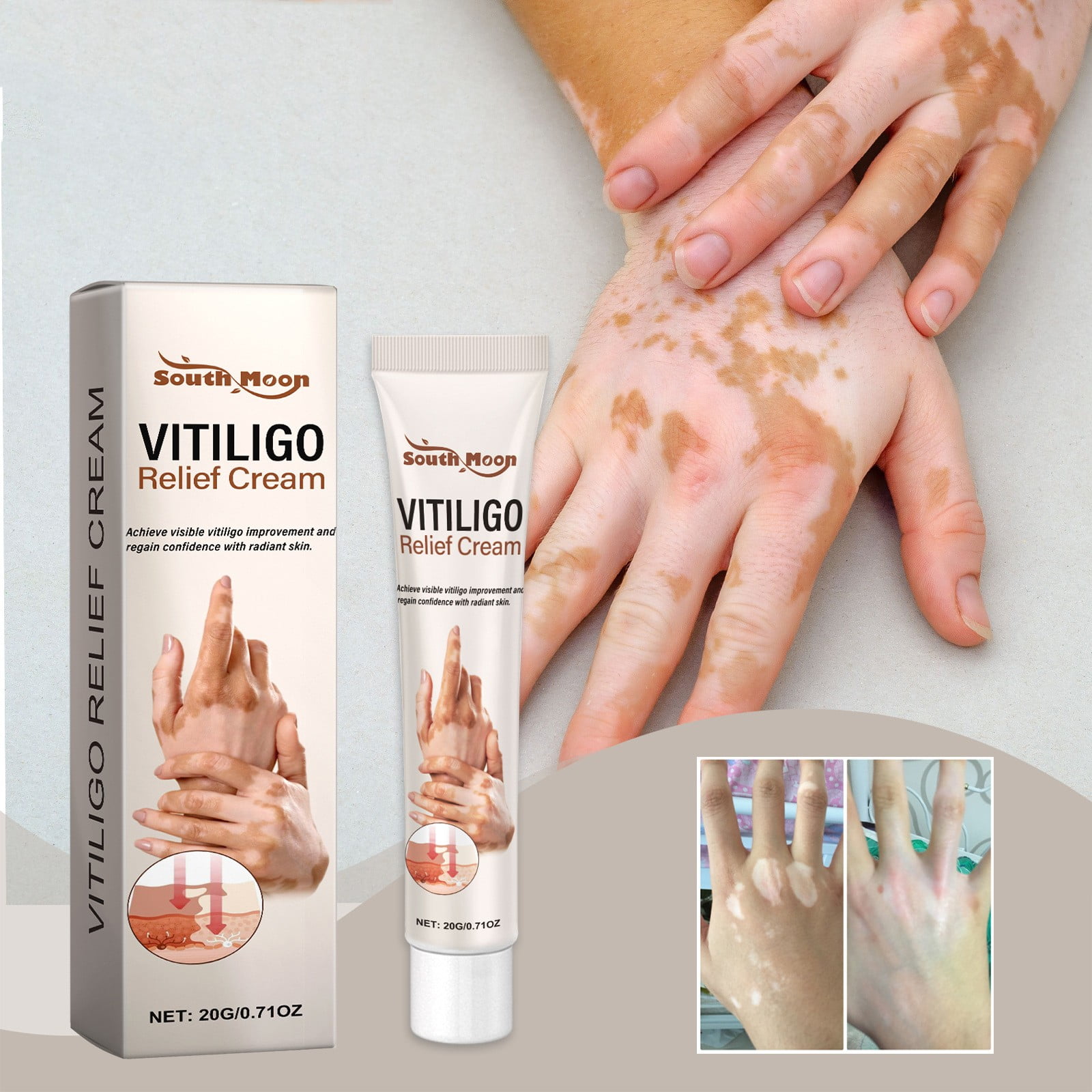 Mitigation Itching, Redness Swelling Itching And Moisturizing Skin Care ...