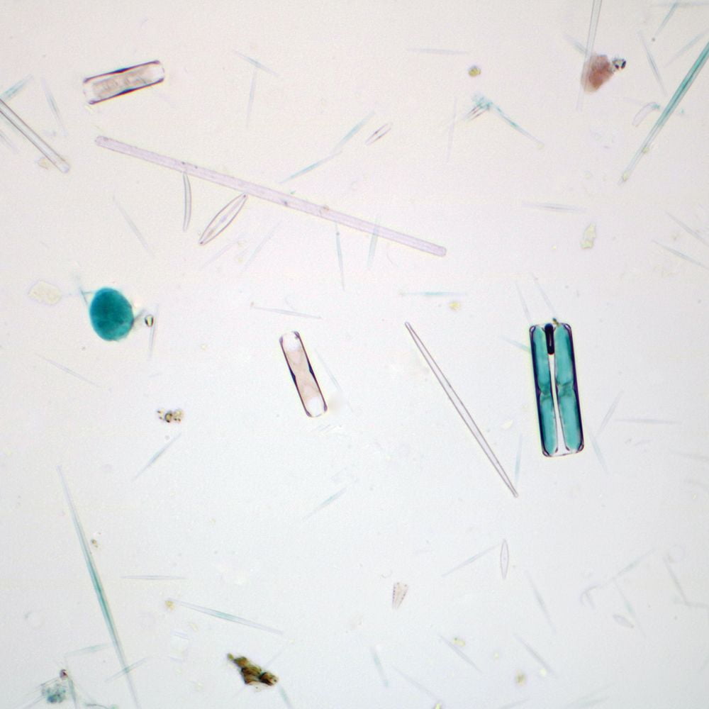 Mixed Diatoms Prepared Microscope Slide, Whole Mount - Walmart.com
