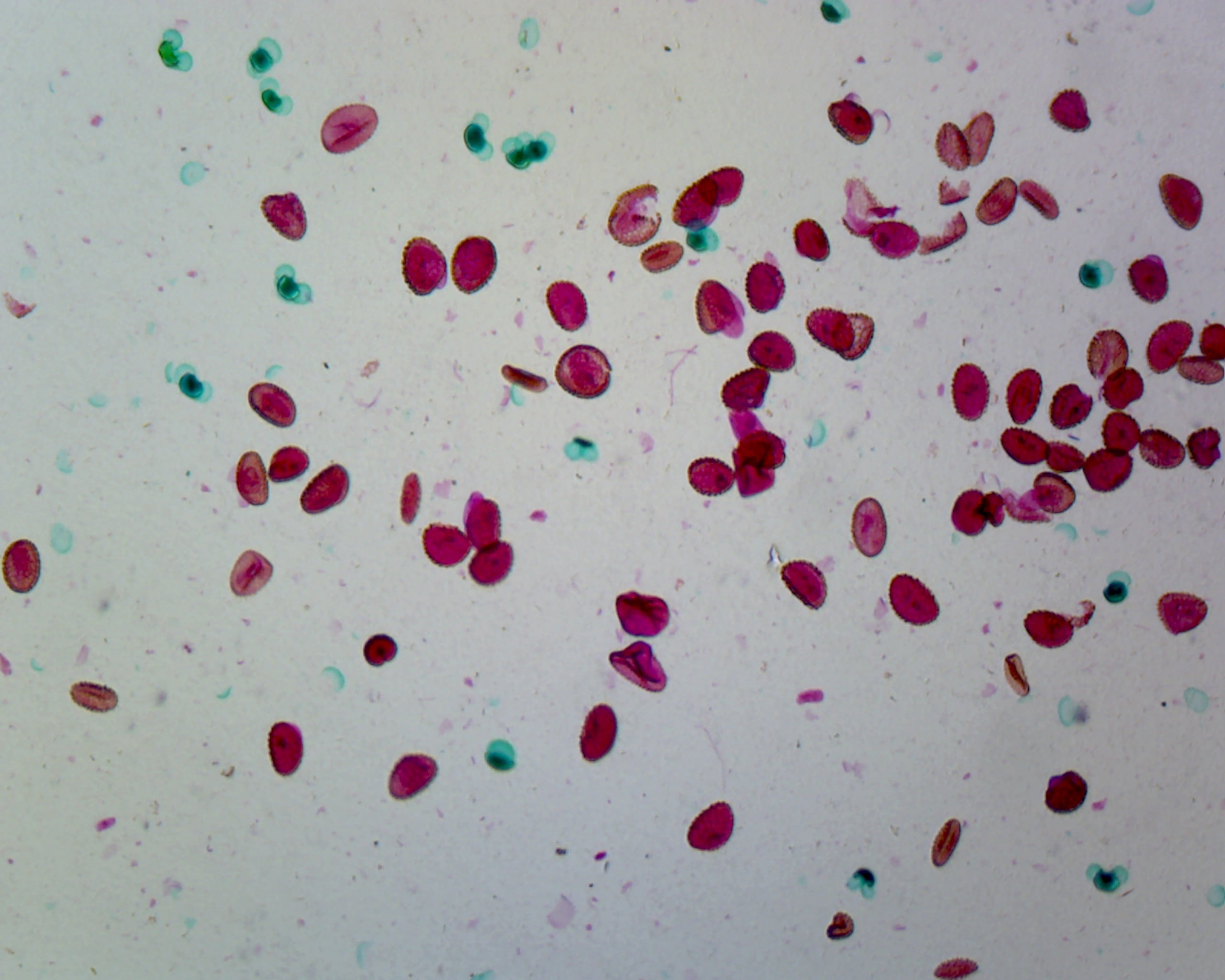 Mixed Pollen Comparison; Typical Dicot Pollens; Whole-mount by Go ...