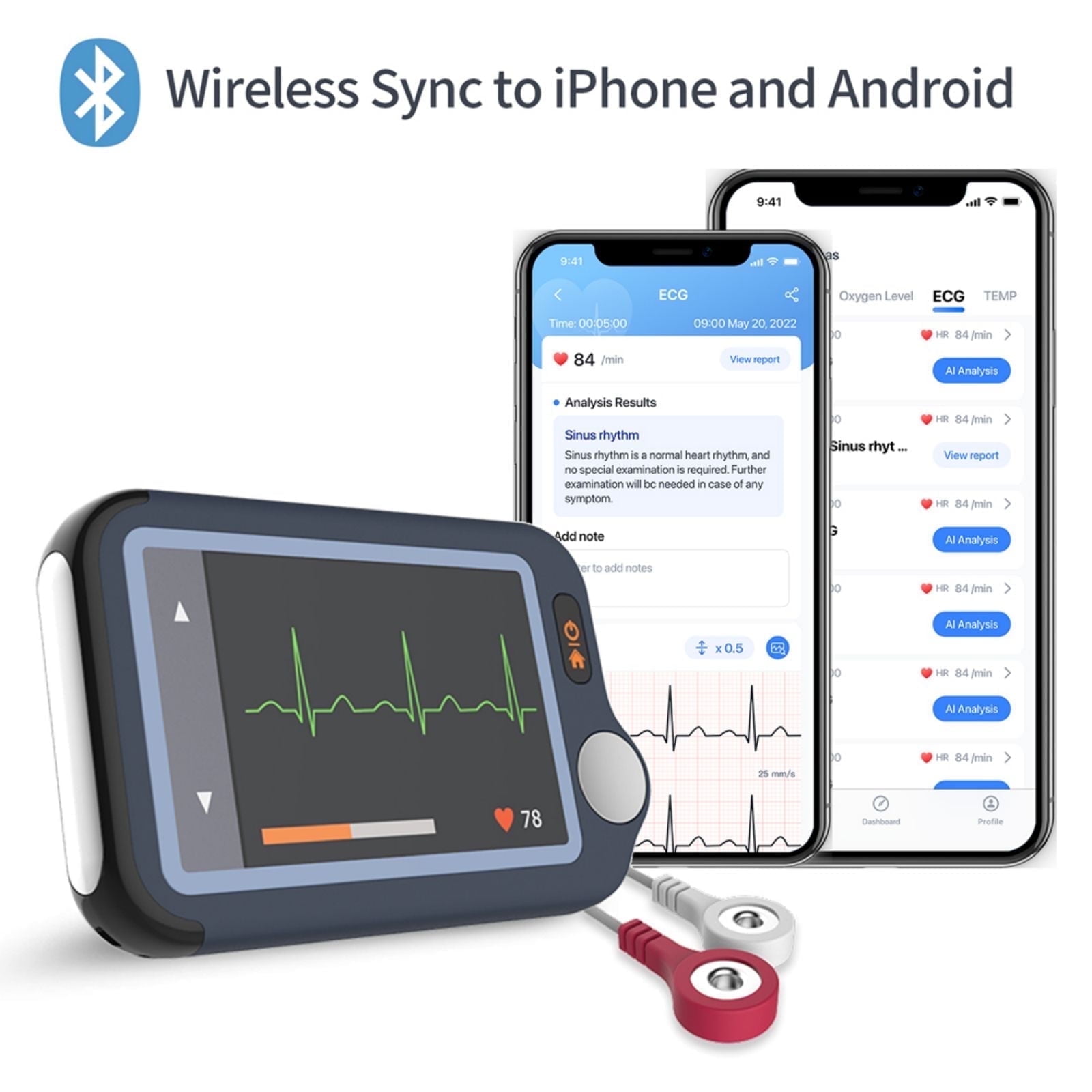 Pulsebit EX Portable Bluetooth Cardio Digital Rhythm EKG Machine ...