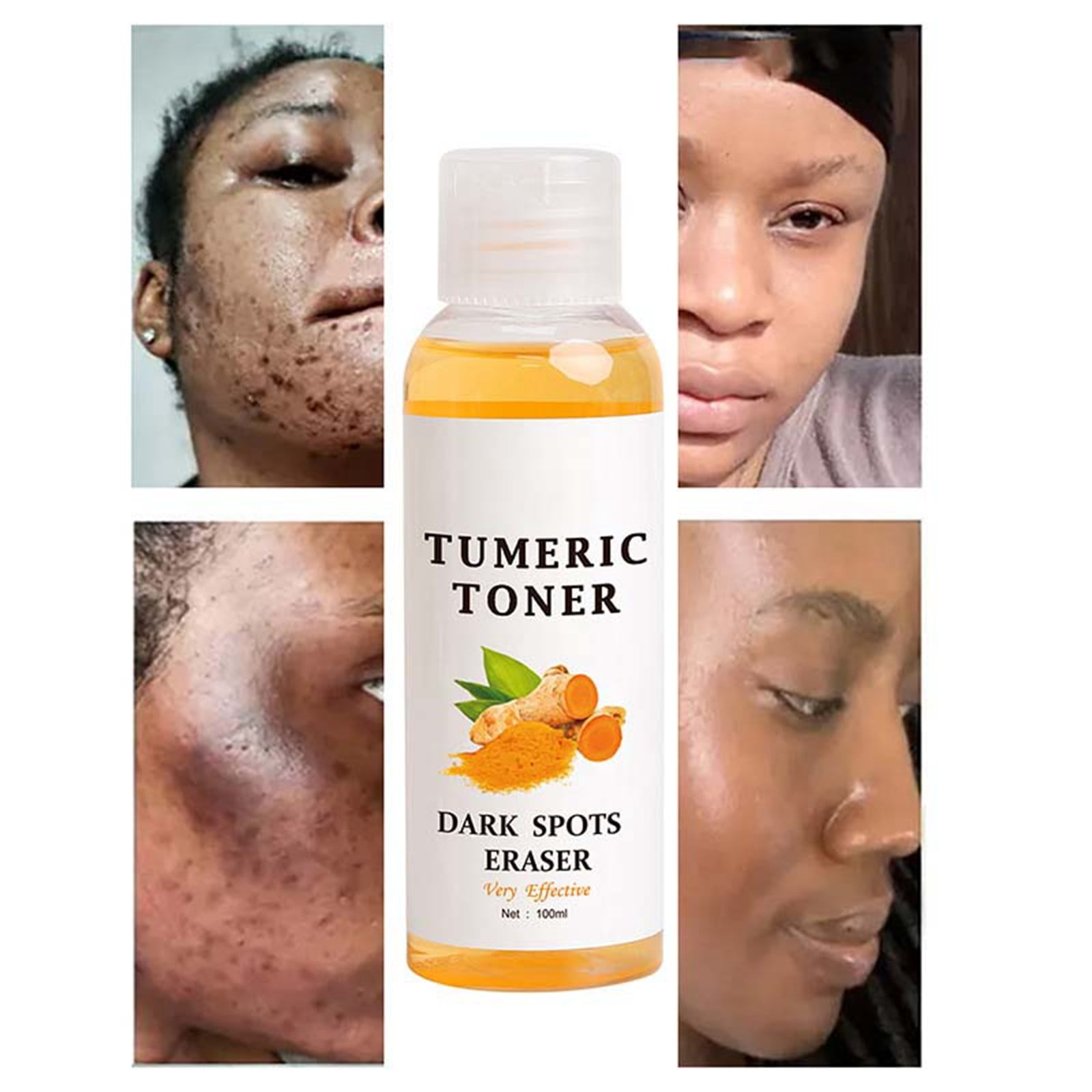 Moisturizer Thermal Label Eraser Toner Dark Water Moisturizing Skin To ...