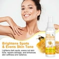 Moisturizing Body Lotion 2024 Hydrating Daily Repair For Dry Skin Wart