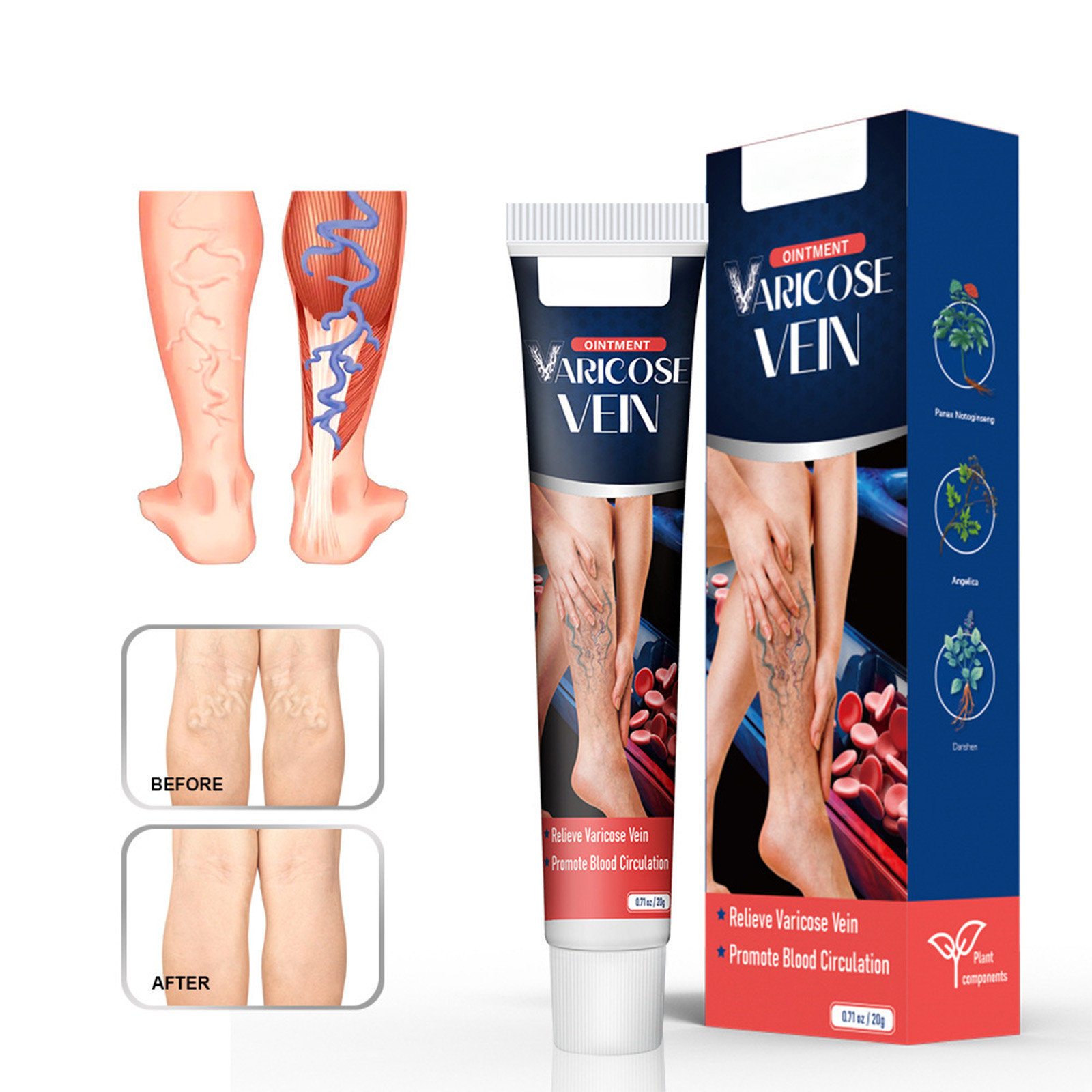 Moisturizing Skin Protect Product for Women Summer Skin, Vein Care ...