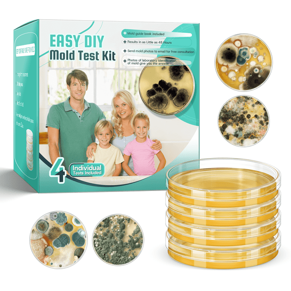 ImmunoLytics DIY Mold Test Kit, 5 Plates, Indoor Air Quality Screening ...