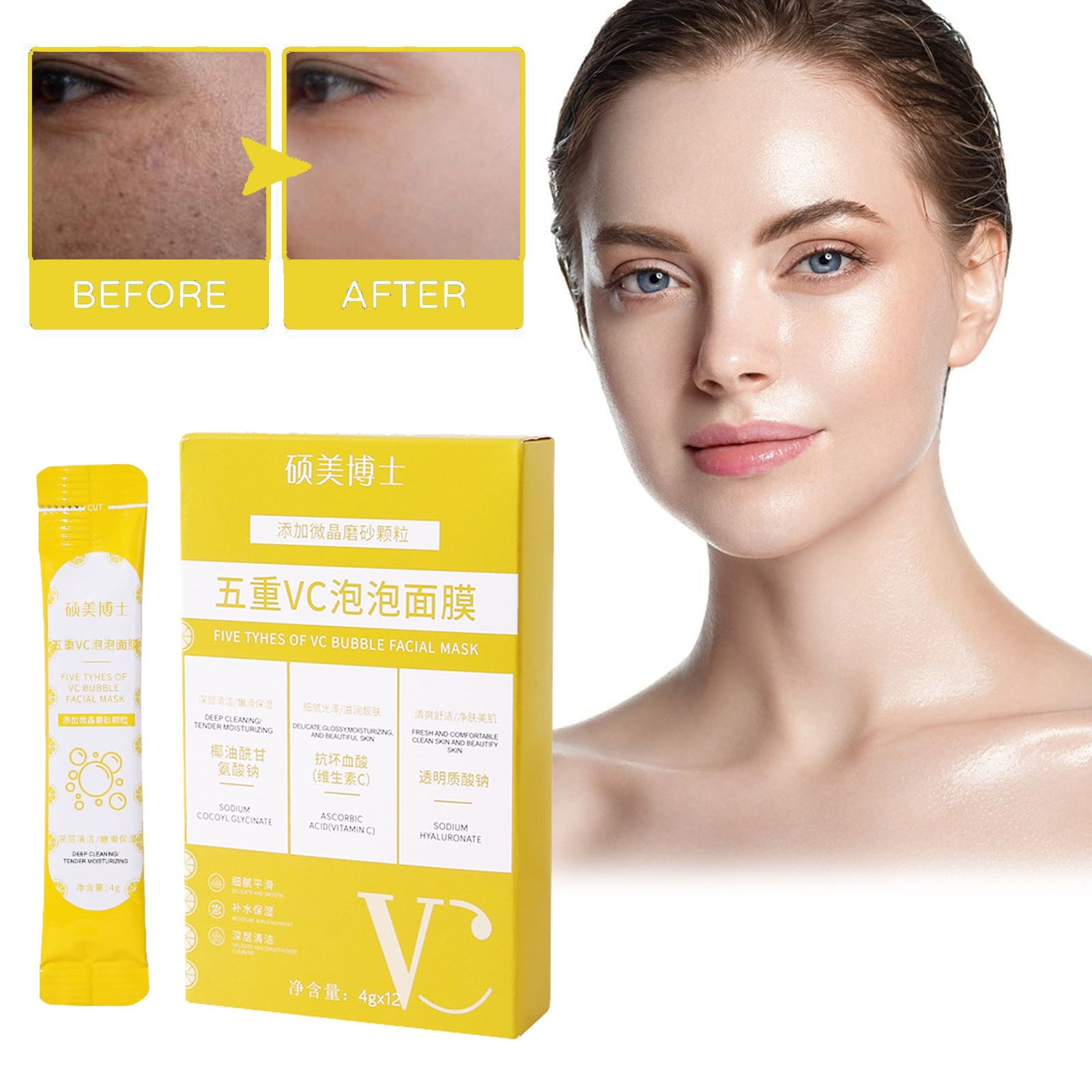 Momihoom Five-fold VC Mask, Moisturizing Blackheads, Cleaning ...