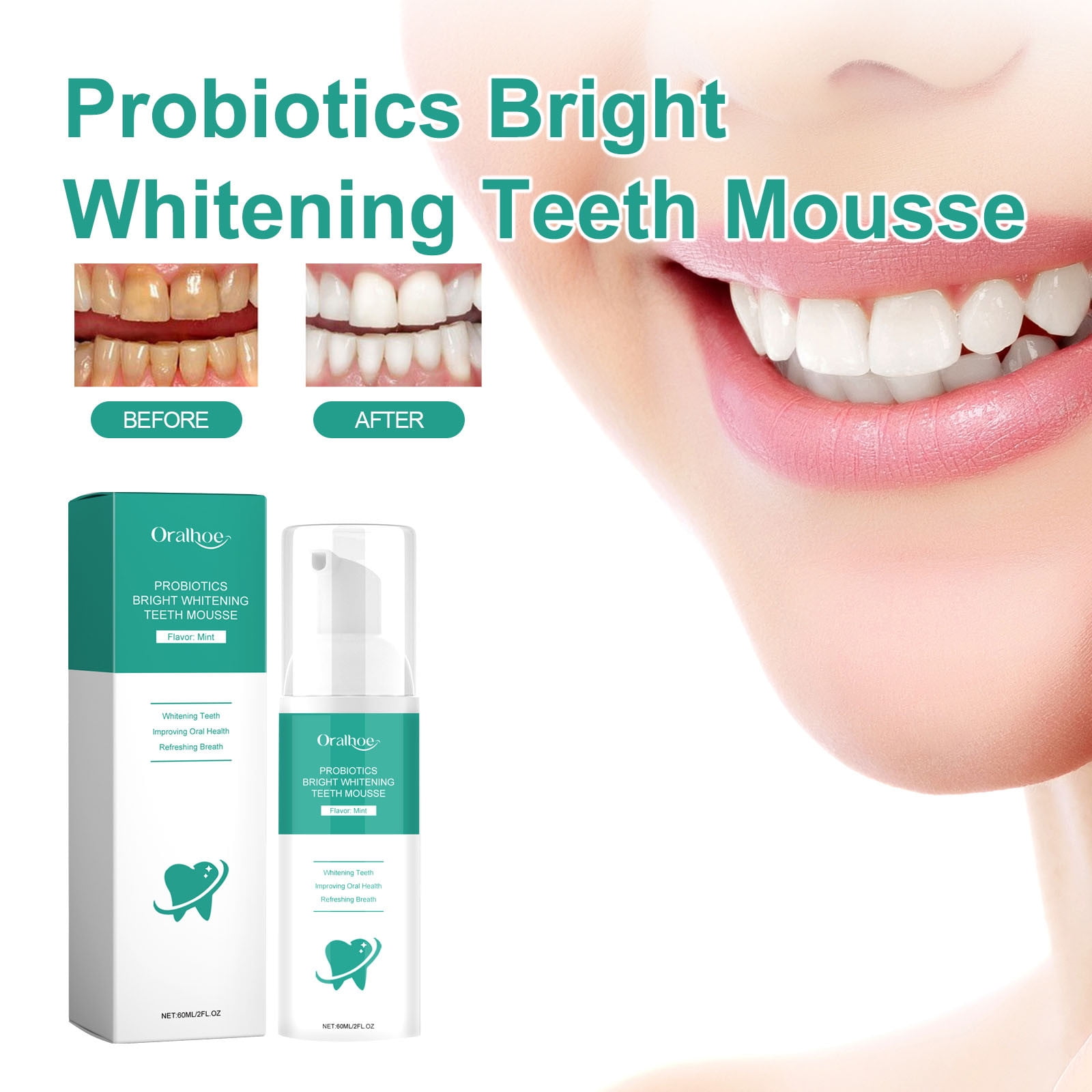 Momihoom Tartar Control Toothpaste for Tartar Removal: Plaque Remover ...