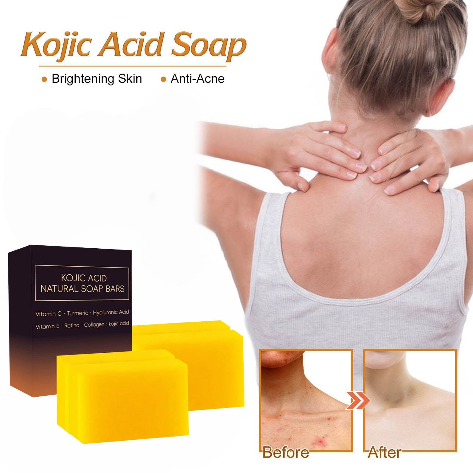 Momihoom Turmeric Kojic Acid Soap for Hyperpigmentation, Skin Brightening Soap for Dark Spots ...