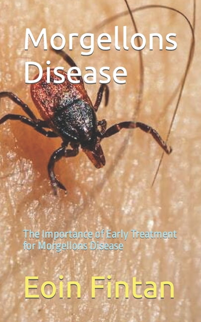 Morgellons Disease: The Importance of Early Treatment for Morgellons ...