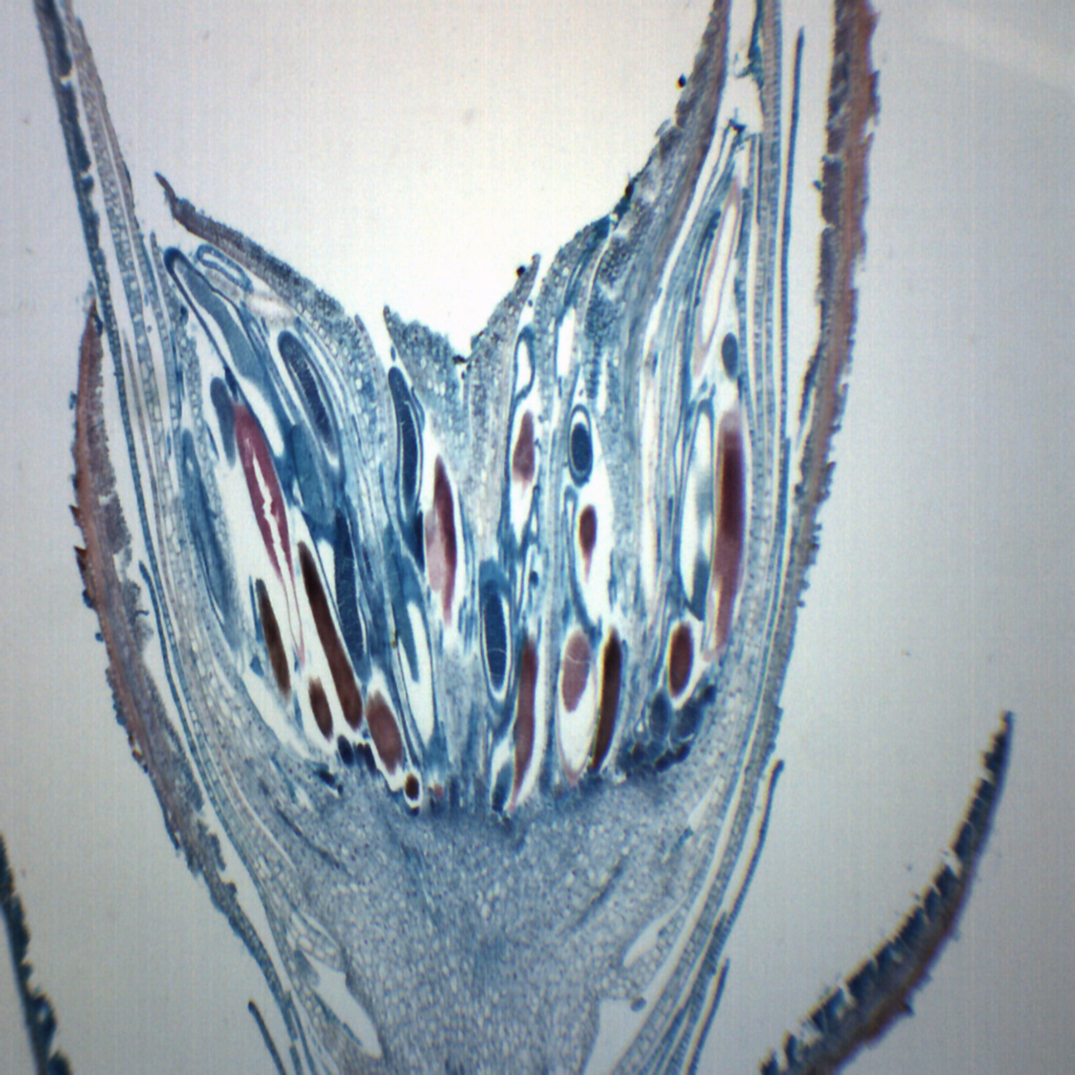 Moss Antheridia, Longitudinal Section - Prepared Microscope Slide - 75 ...