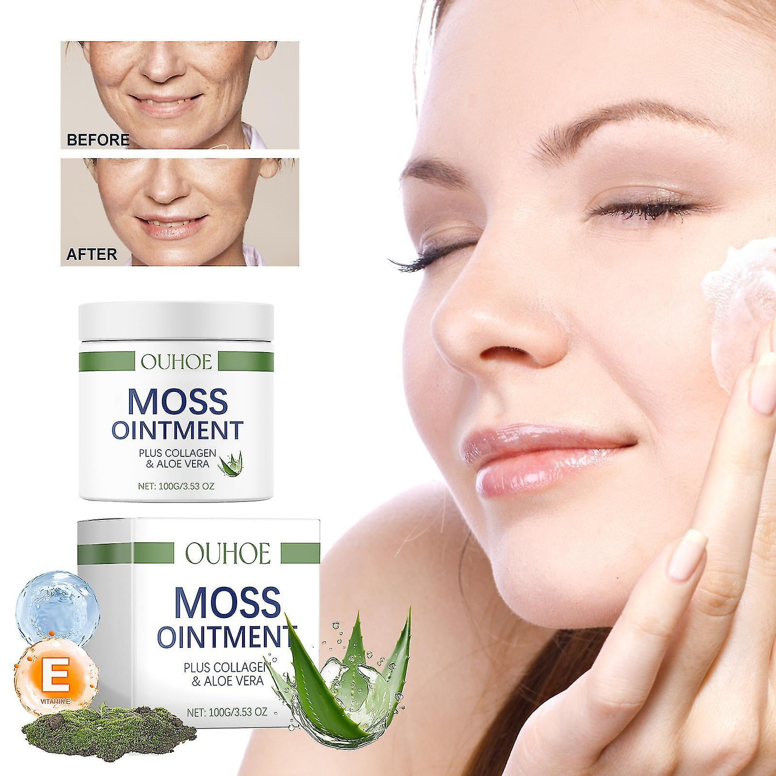 Moss Ointment Plus, Moss Anti-Wrinkle Cream, Fast Acting Facial Anti ...