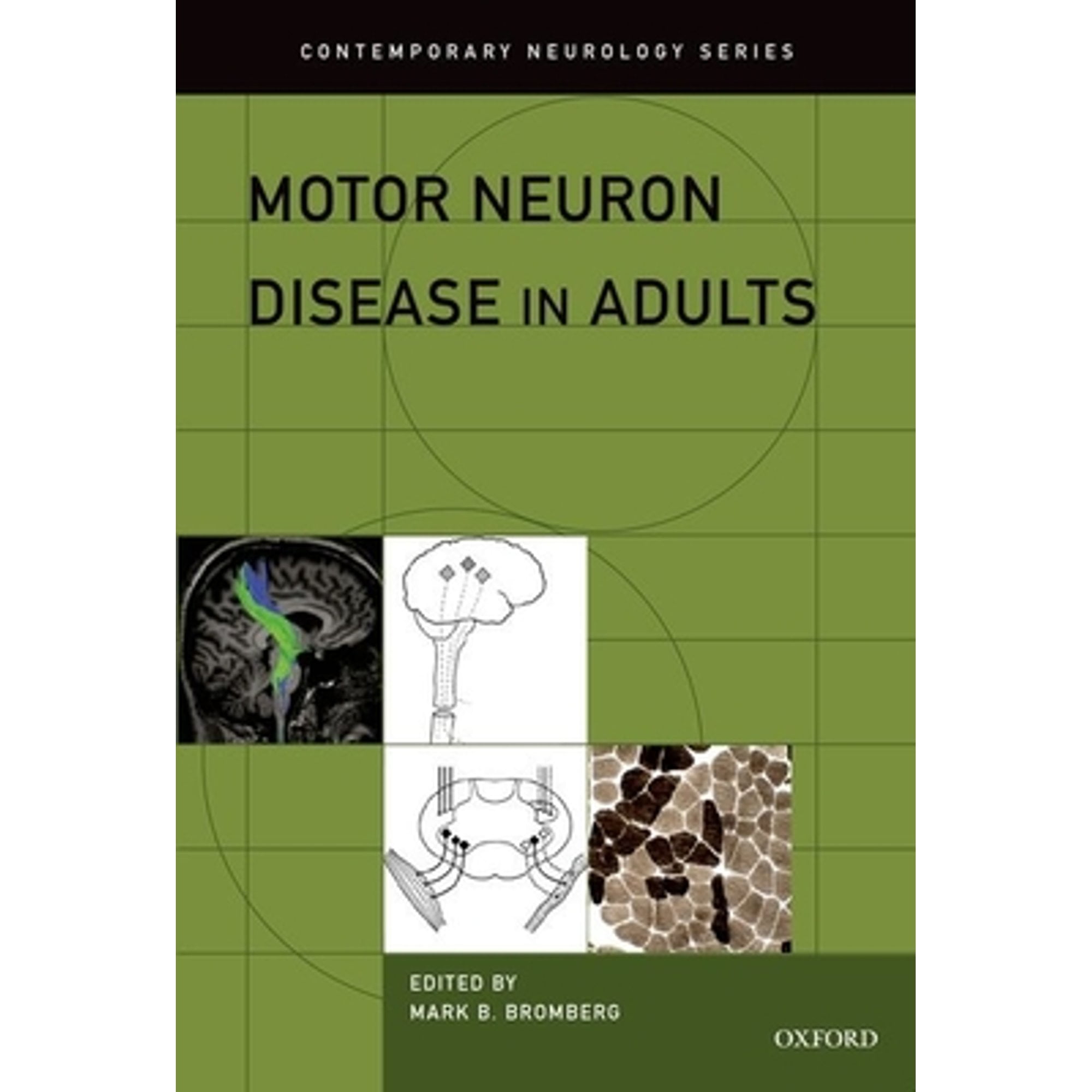 Pre-Owned Motor Neuron Disease in Adults (Hardcover) 019978311X ...