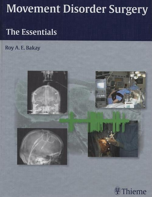 Movement Disorder Surgery: The Essentials - Walmart.com