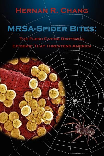 Mrsa - Spider Bites : The Flesh-eating Bacterial Epidemic That ...