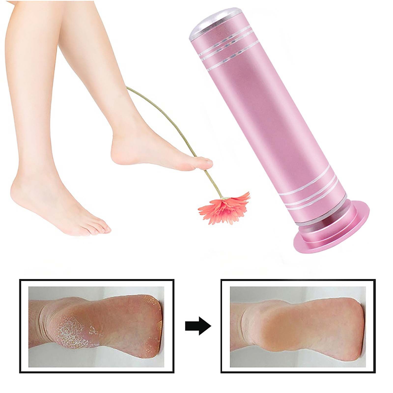 MuYan Electric Foot Grinder for Callus Removal,Plug-in Exfoliating Tool,Soften Feet,Soothing ...
