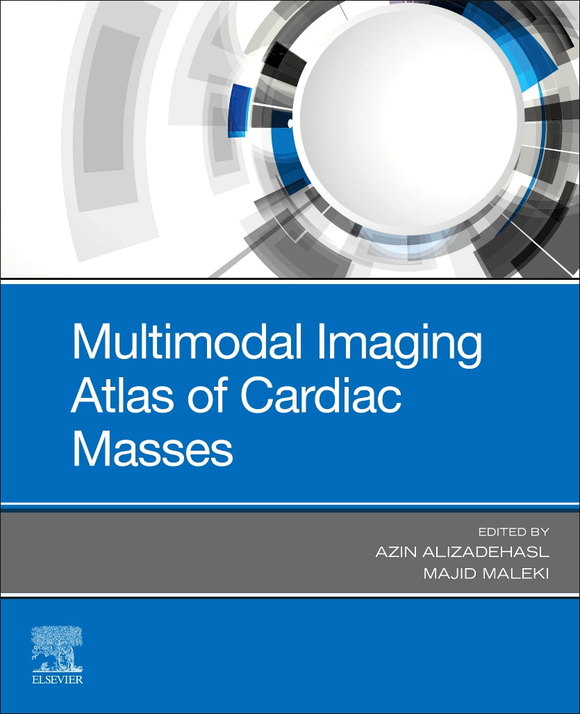 Multimodal Imaging Atlas of Cardiac Masses - Walmart.com
