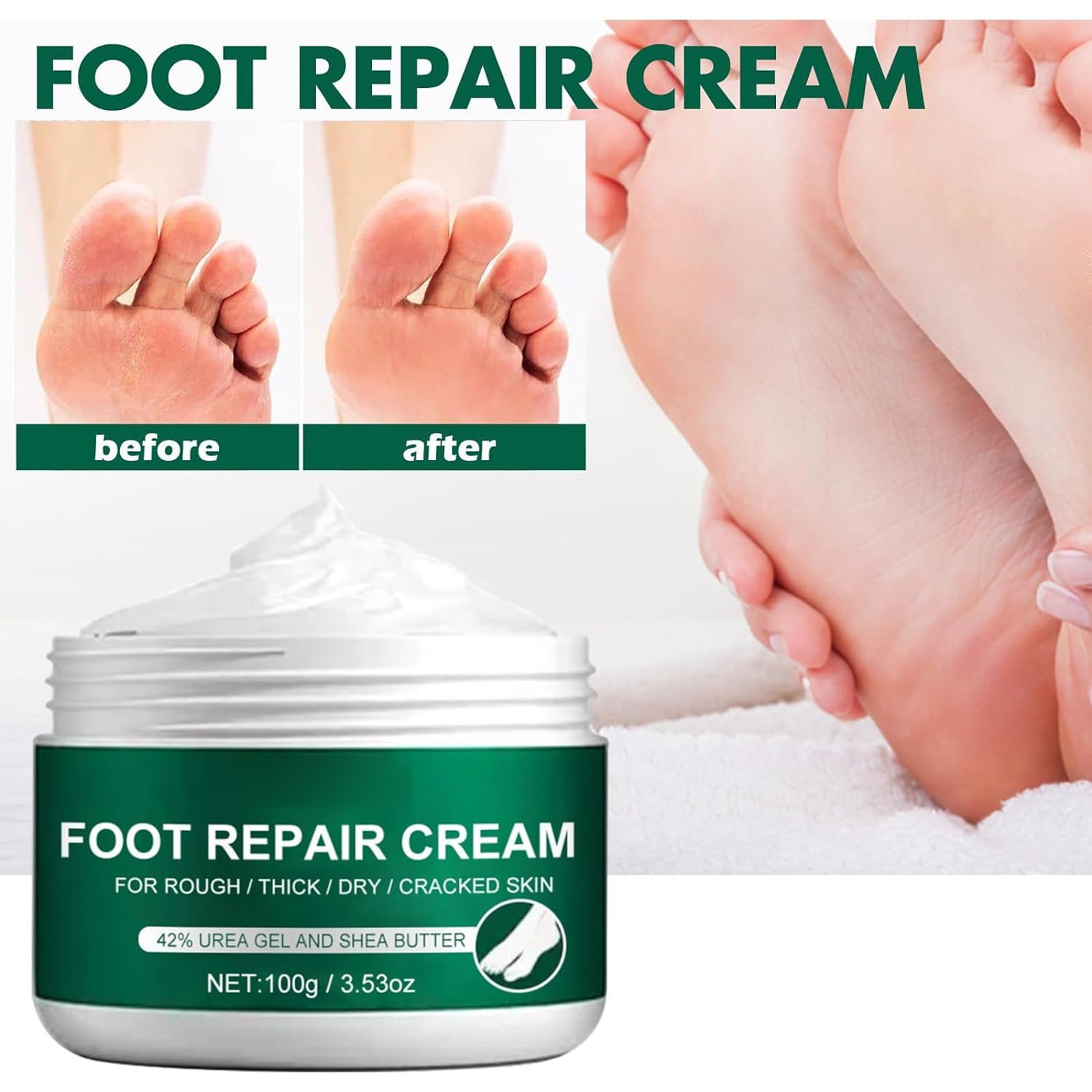 Musatteng Crusty Feet Skin Crack Care Foot For Rough Thick Dry Skin ...