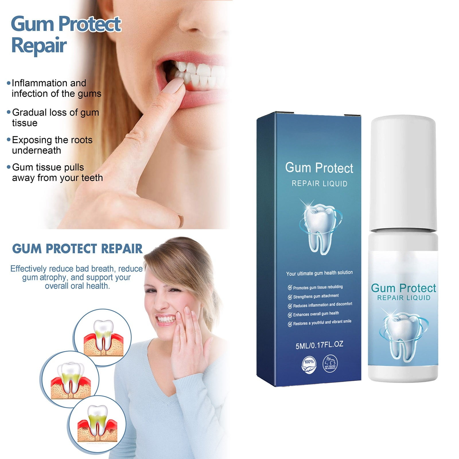 Musatteng Gingival Cleaning Of Stains And Yellowing And Of Teeth Oral ...