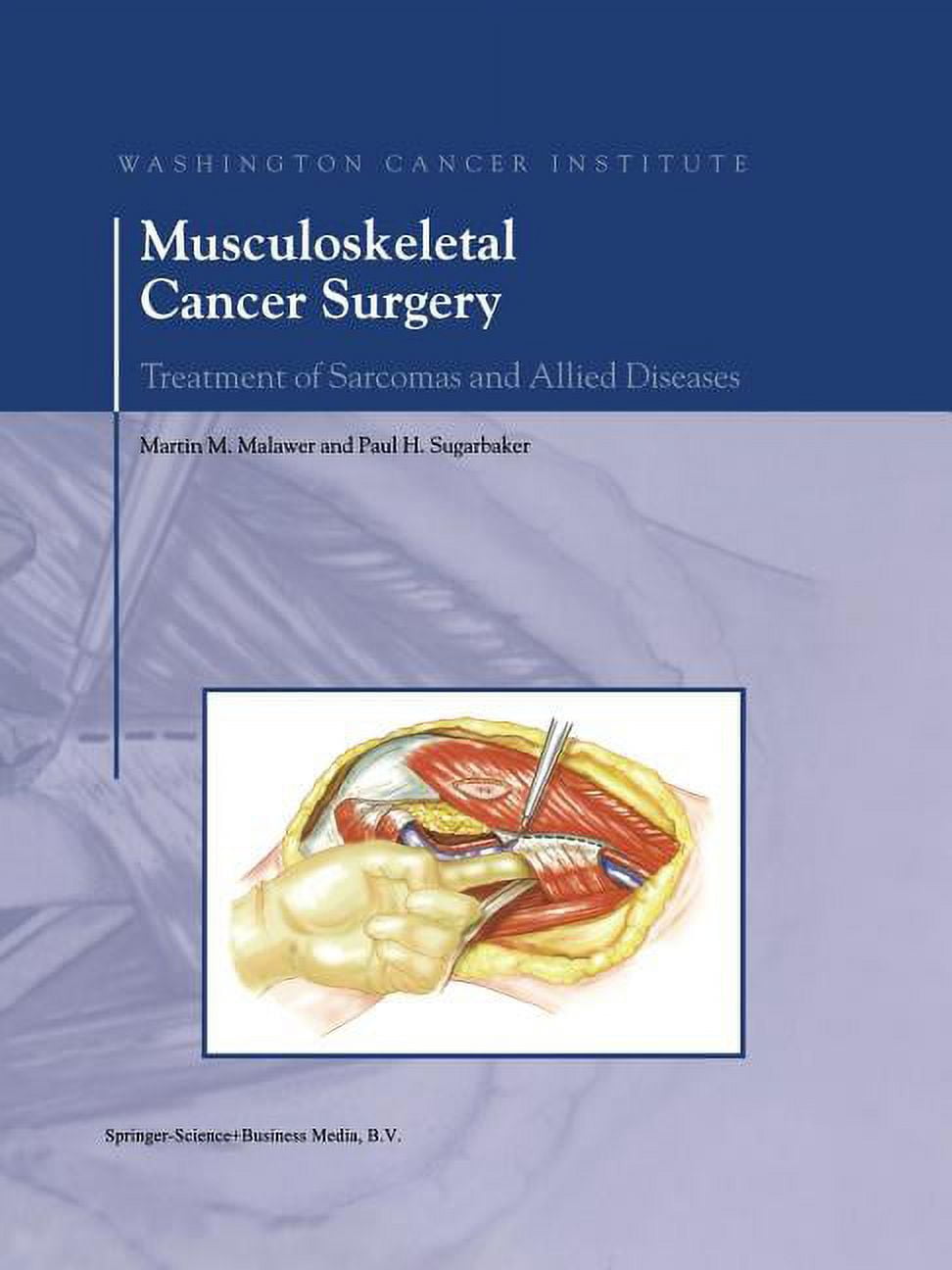 Musculoskeletal Cancer Surgery: Treatment of Sarcomas and Allied ...