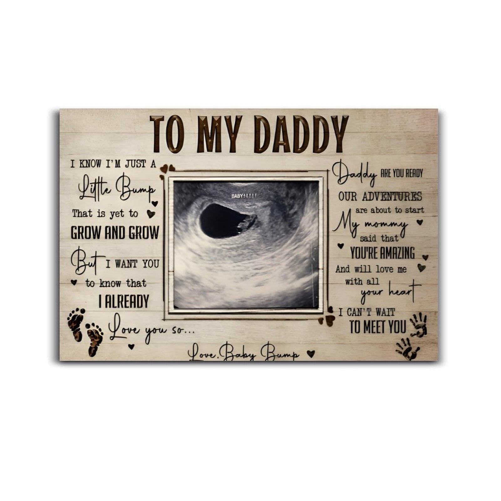 My Daddy Little Bump Ultrasound Poster Great Wall Art for Home Decor ...